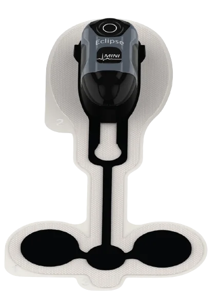 Diagnostic par holter – gervasy